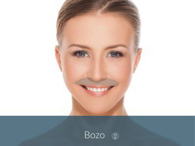 Depilación Láser - Bozo