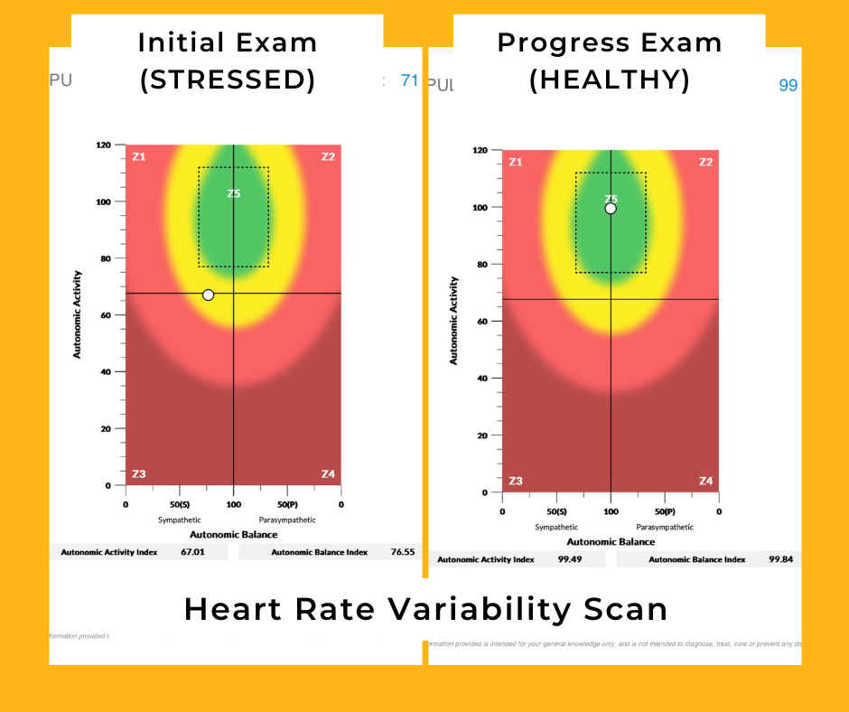 What is Heart Rate Variability?