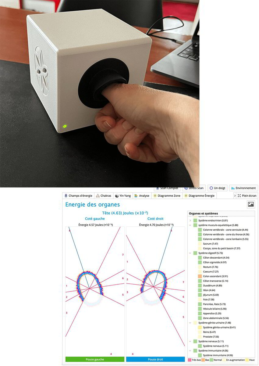 NES MIHEALTH - Appareil de Biofeedback très puissant