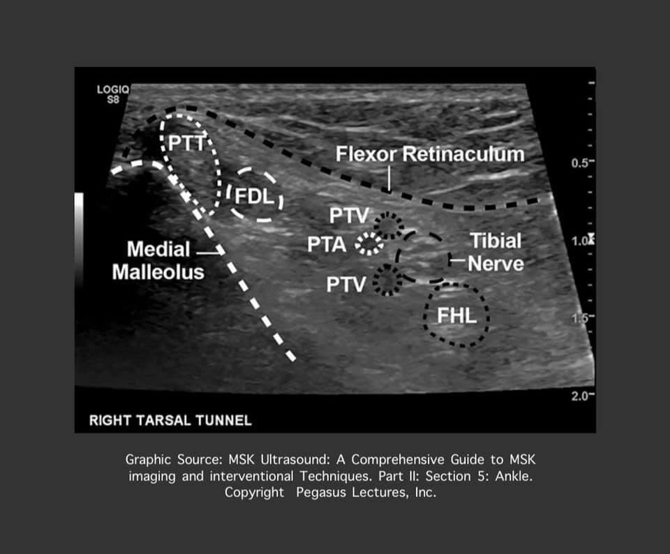 Anatomy Mri Msk at Nina Pierson blog