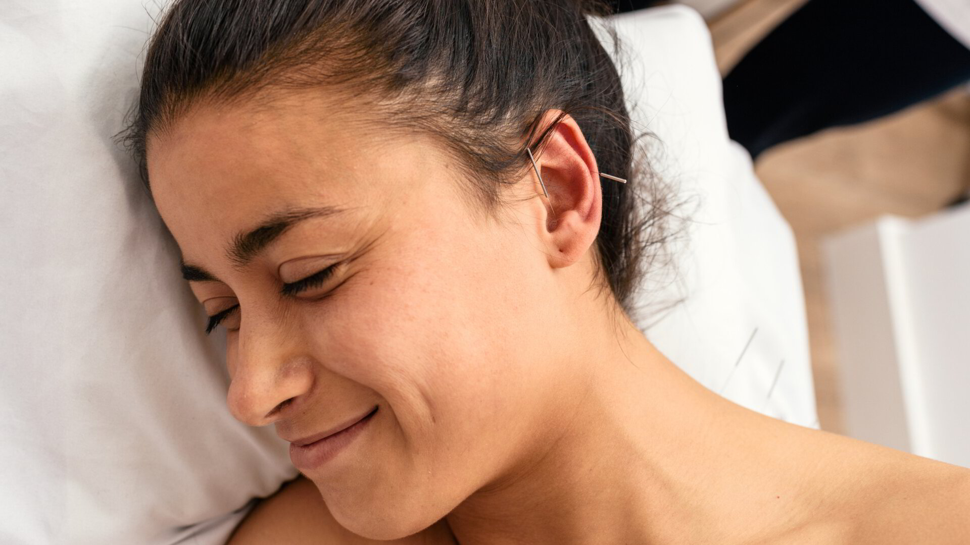 Ear Acupuncture: The Healing Potential Of Auricular Therapy
