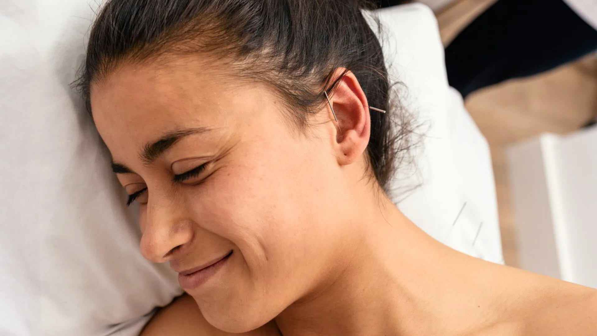Ear Acupuncture: The Healing Potential Of Auricular Therapy
