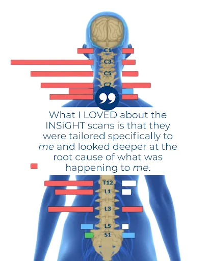 Understanding Your Child’s Nervous System with INSiGHT Scans