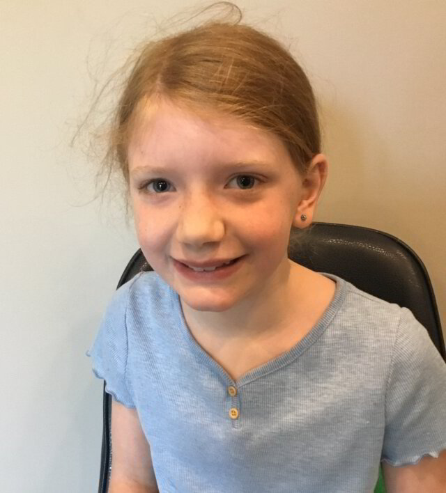 Even her hair has started growing back, which has been our biggest win ...