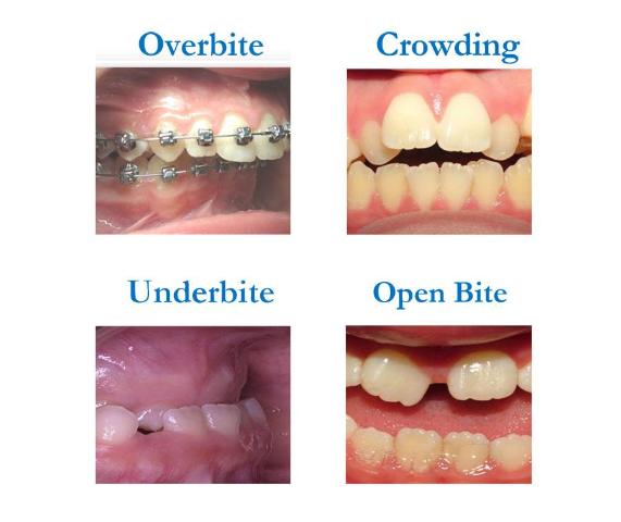 When should I take my child to the orthodontist?