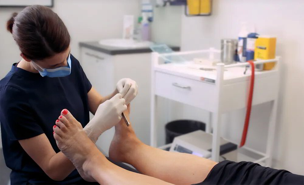 Ingrown Toe Nails - Boroondara Podiatry Centre