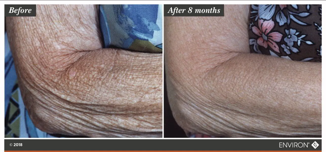Before & After | Luxury Facial Results | Michelle’s Hidden Spa ...