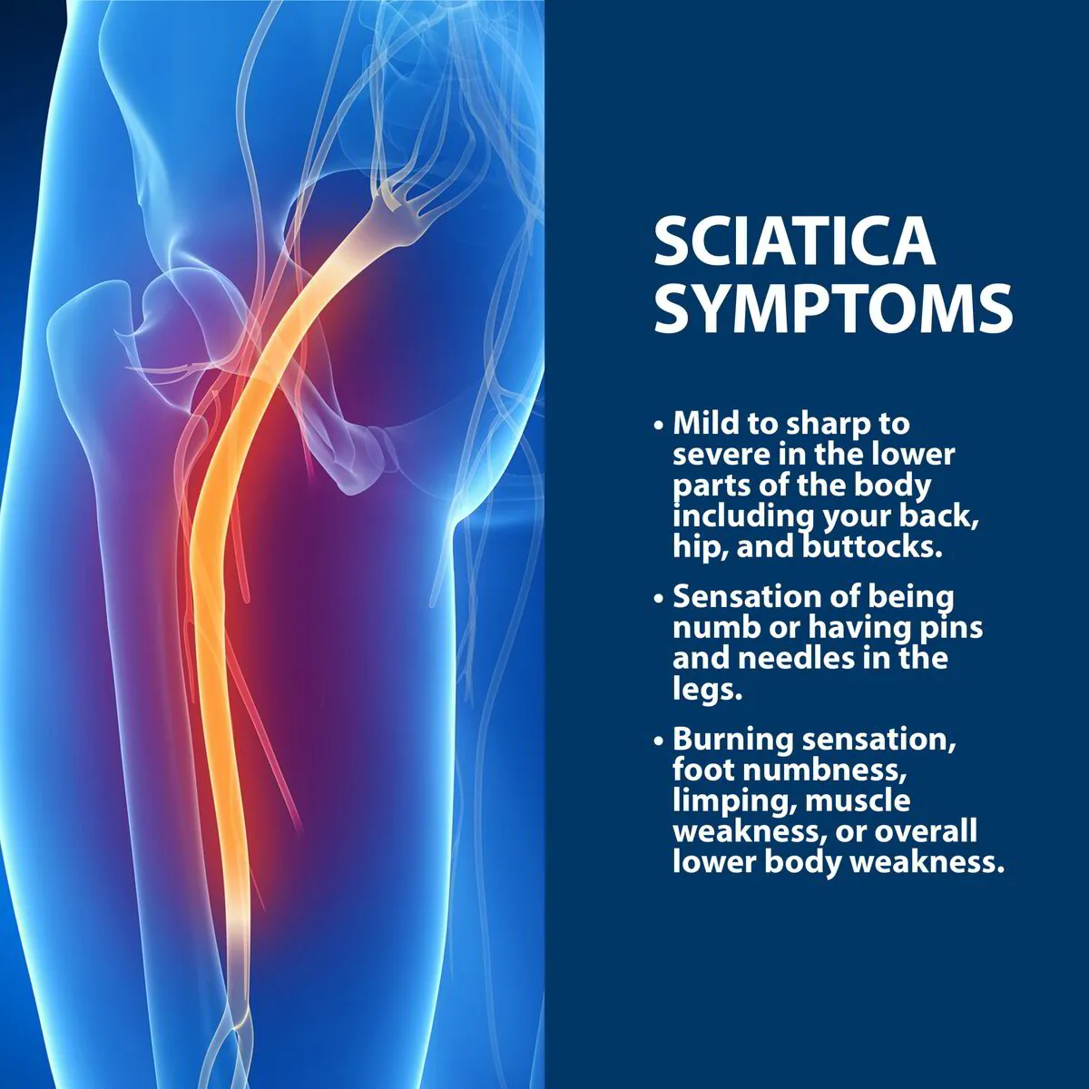 Massage to relieve sciatic pain store