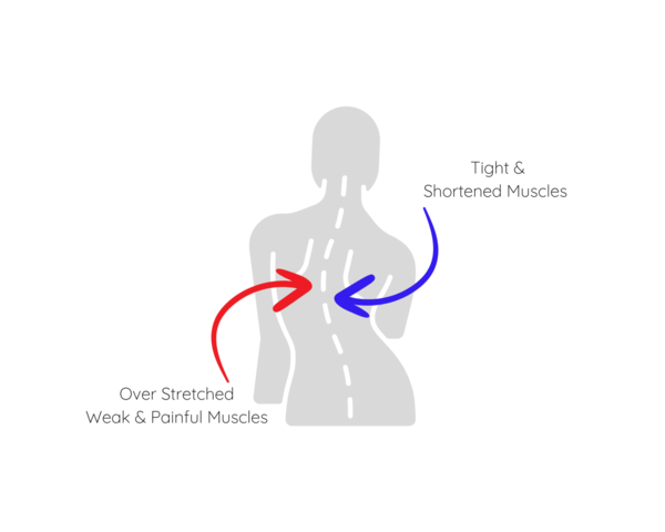 Suffering with back pain!