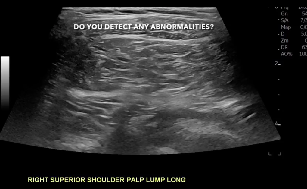 Do You Need To Learn MSK Sonography?